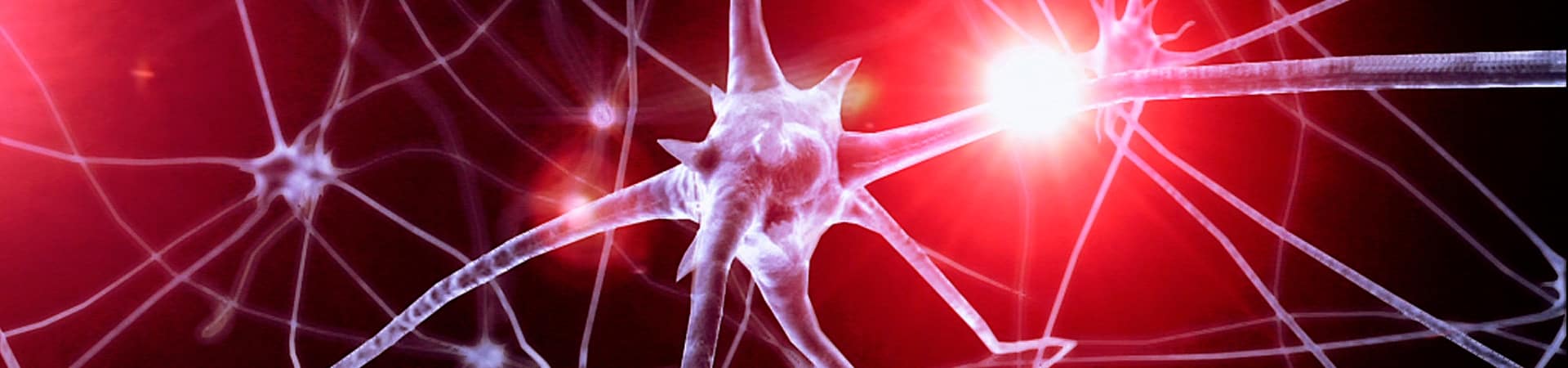 Radiofrequency Ablation