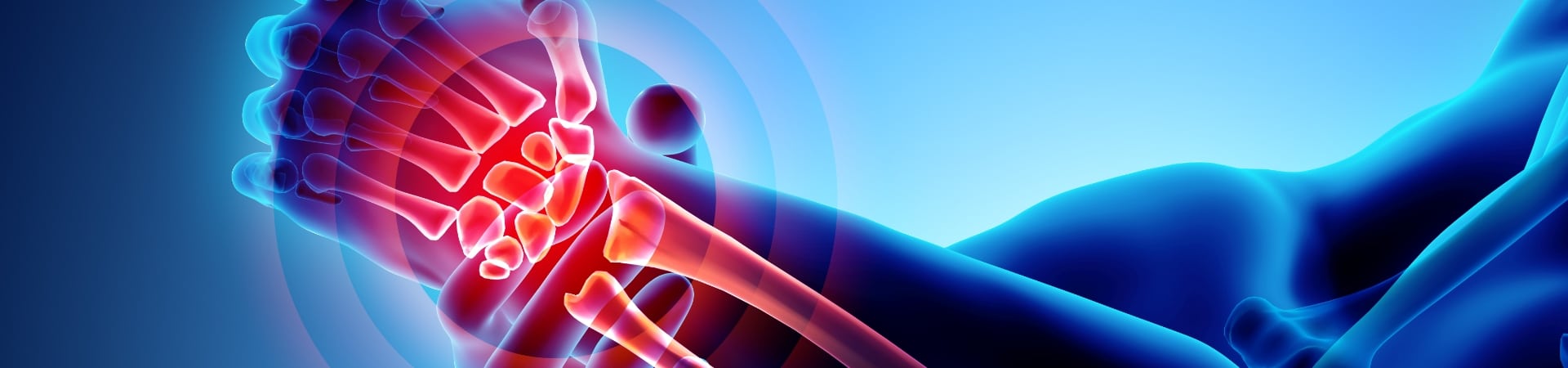 Carpal Tunnel Charlotte, NC - Integrative Pain & Spine Institute